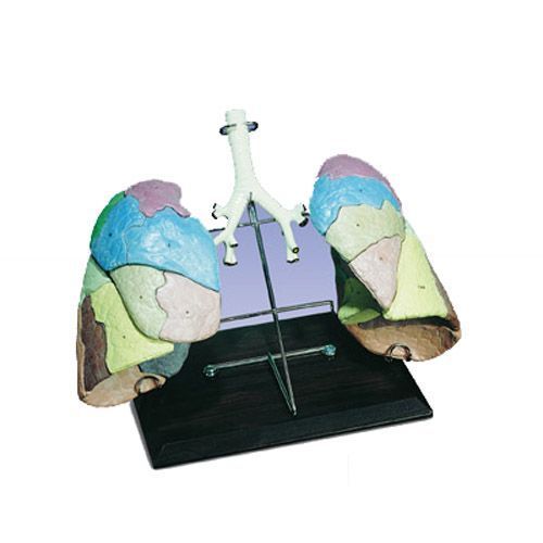 Segmented Lung Reproduction W47029 for £1.36 in Lung anatomy model